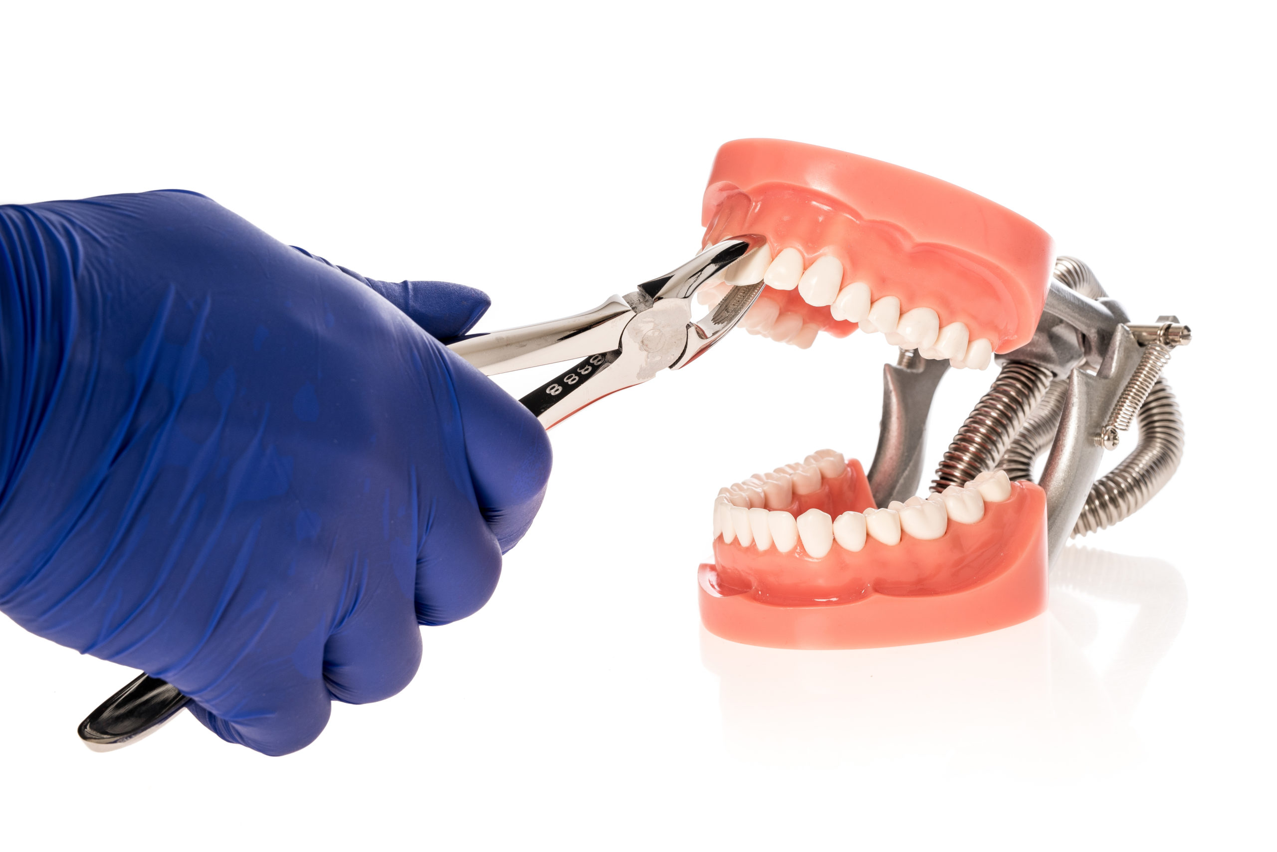 Extractii si Alveolotomii - Optimutil