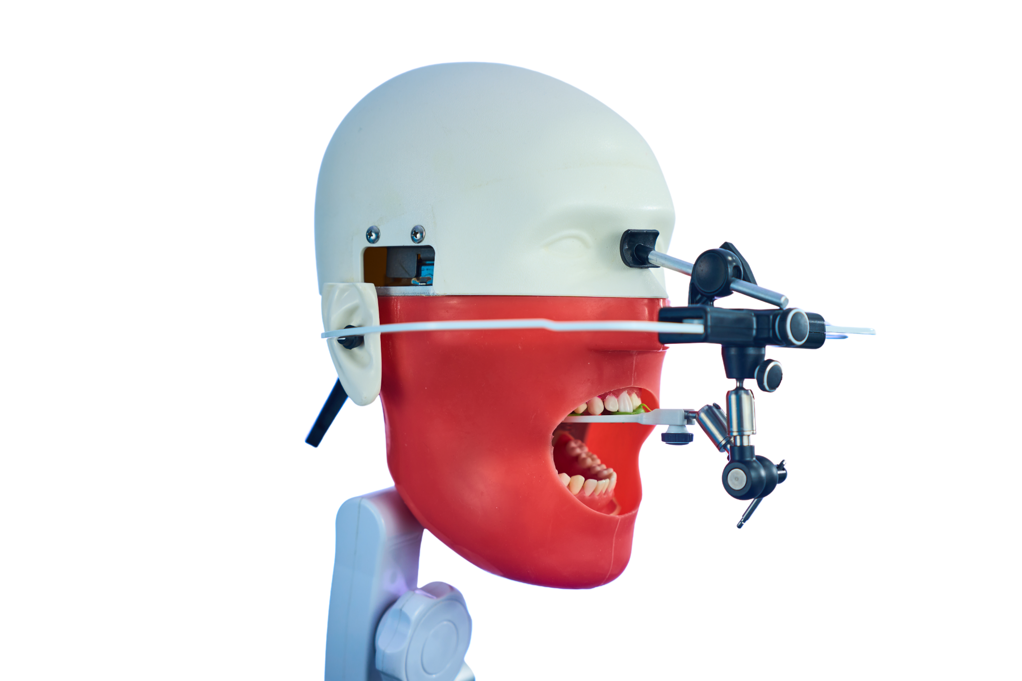 Reabilitari Orale Complexe - Optimutil